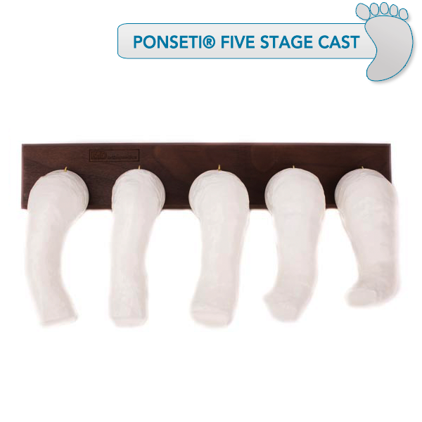 Five Stage Cast Model Set – Massons Healthcare